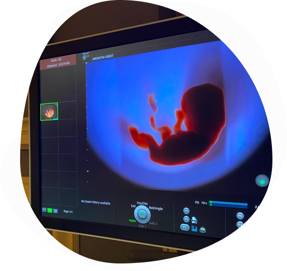 CRP Clinic – Centre for Reproductive Immunology and Pregnancy