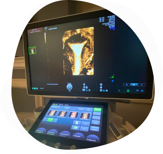 CRP Clinic – Centre for Reproductive Immunology and Pregnancy